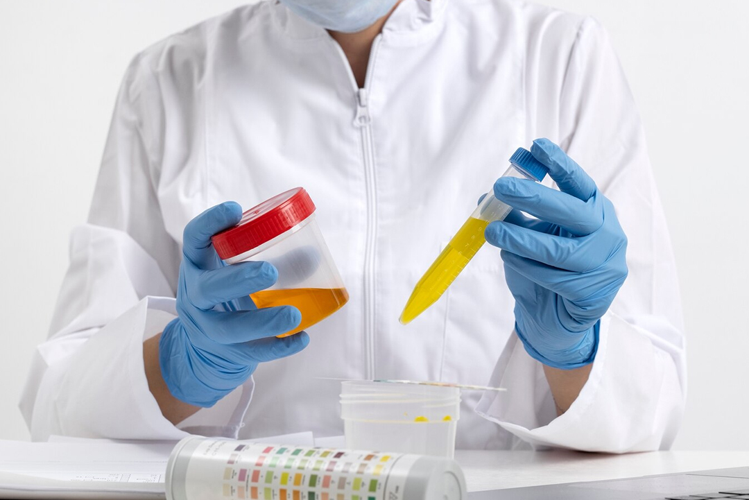Urine Examination – Dr Vohra's Medilab