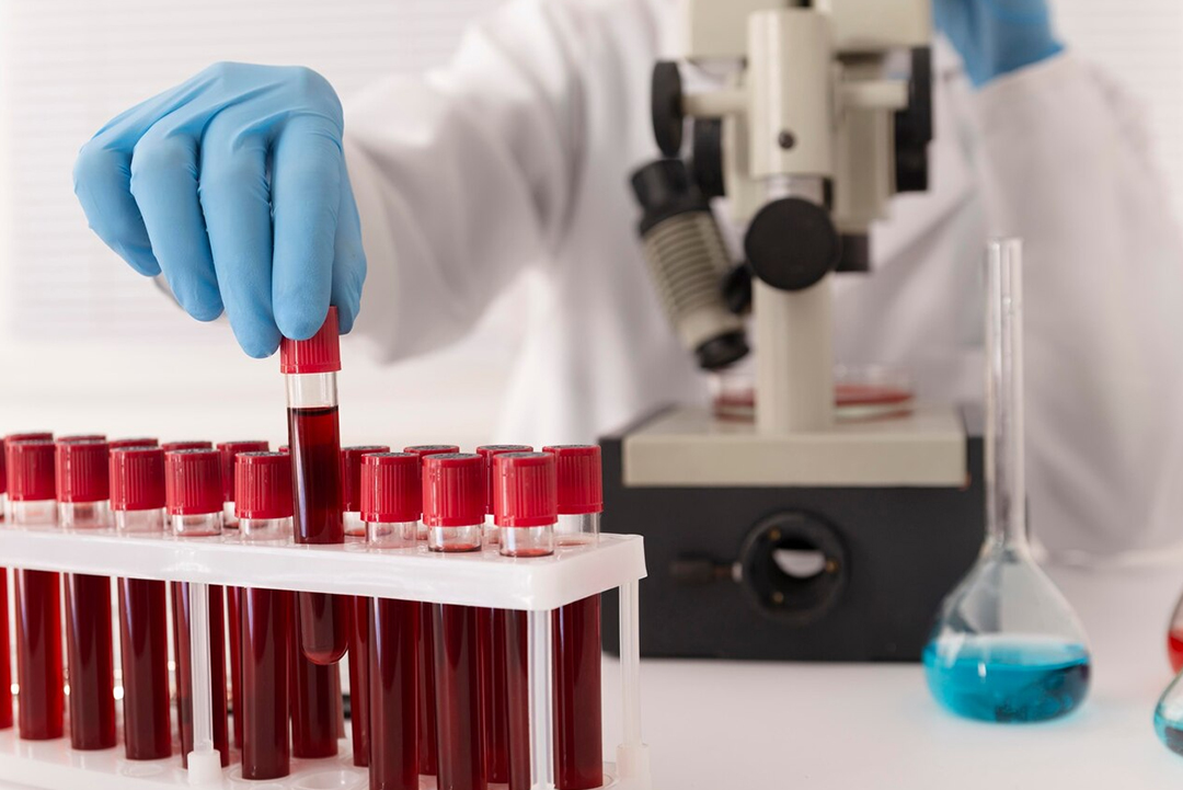 Blood Test – Dr Vohra's Medilab